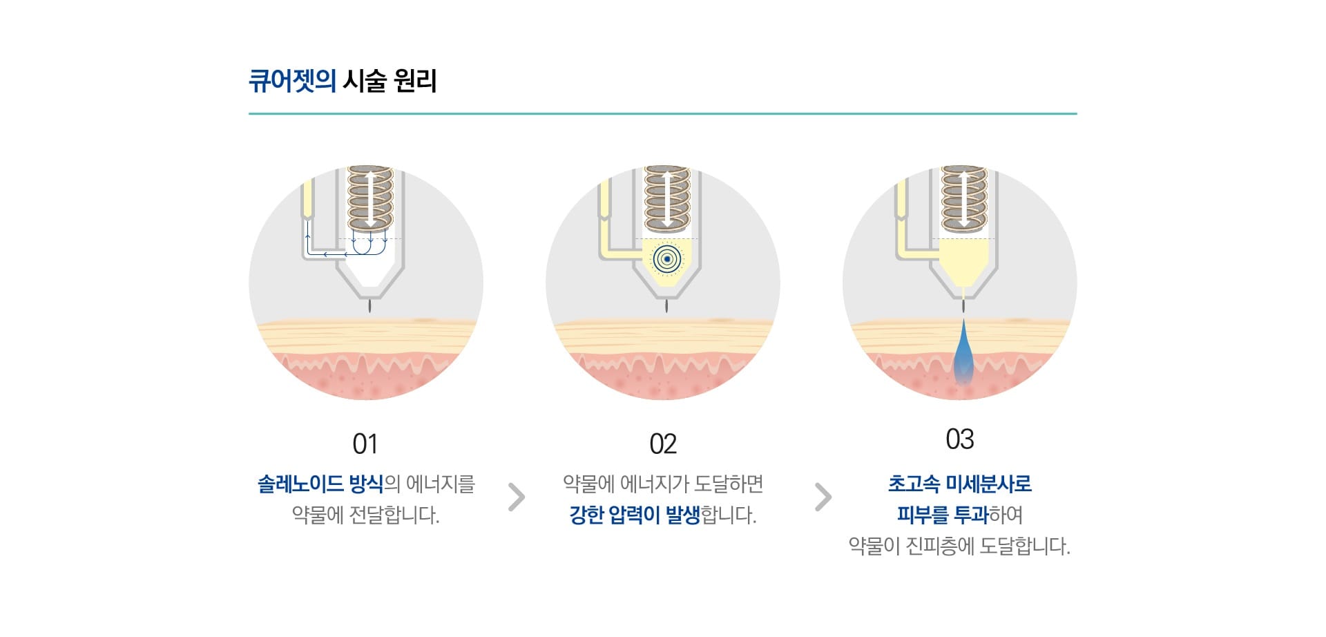 큐어젯(Cure-Jet) | 바늘없는 주사 - 모공, 흉터, 튼살, 탈모, 안티에이징 치료 - 미모드림의원